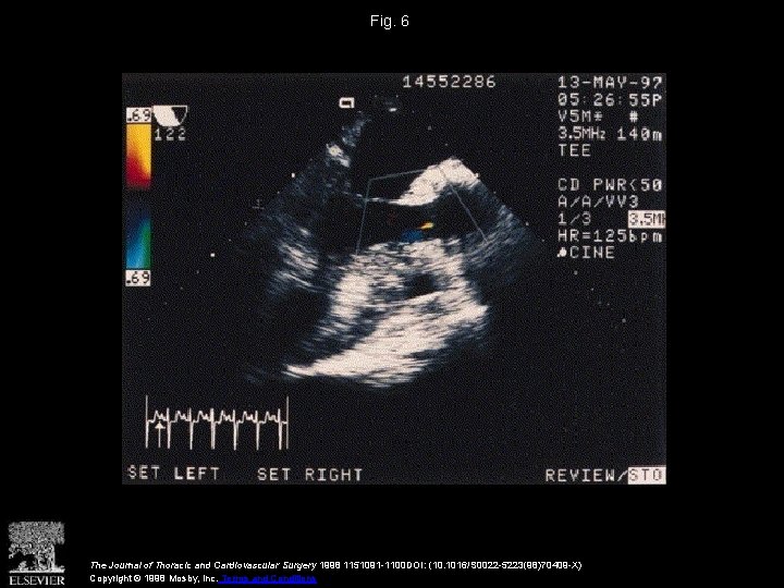 Ten years of experience with the modified Ross