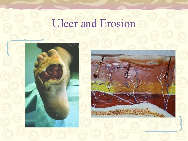Integumentary System Altered Functions Vocabulary Derma Melano Pachy
