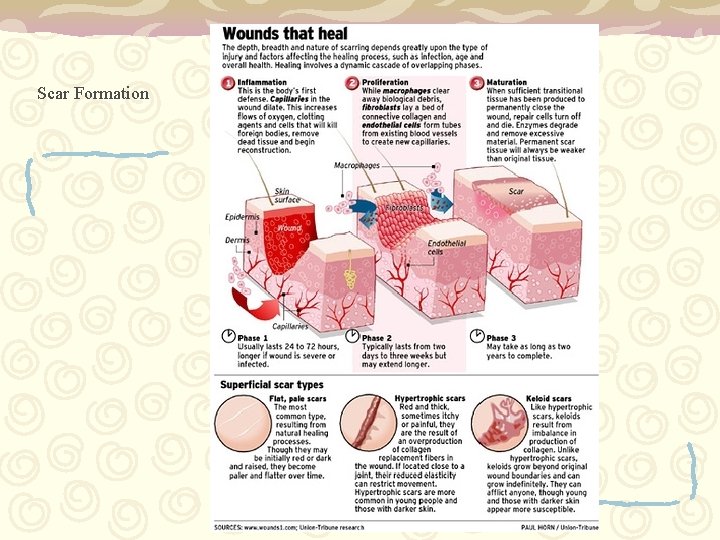 Integumentary System Altered Functions Vocabulary Derma Melano Pachy