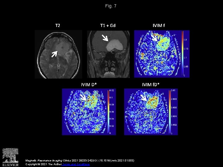Measuring Perfusion Christian Federau MD MSc Magnetic Resonance