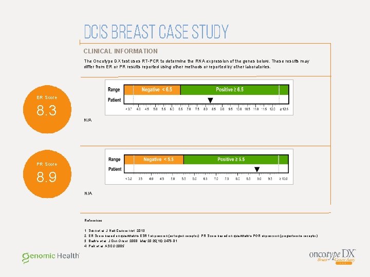 AGE 45 DCIS Breast Case Study PATIENT TUMOR