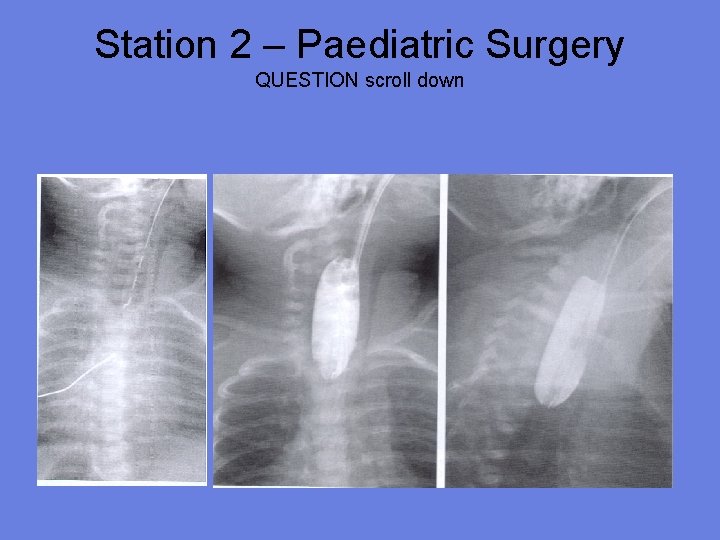 Department of Surgery OSCE Paediatric Plastic Vascular Surgery