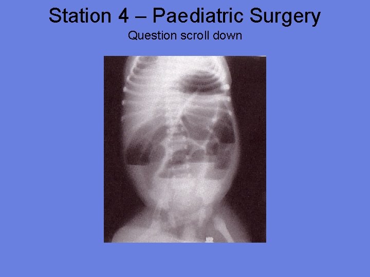 Department of Surgery OSCE Paediatric Plastic Vascular Surgery