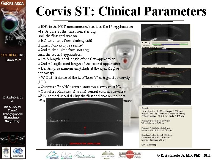 Corneal Biomechanical Assessment using Dynamic Ultra HighSpeed Scheimpflug