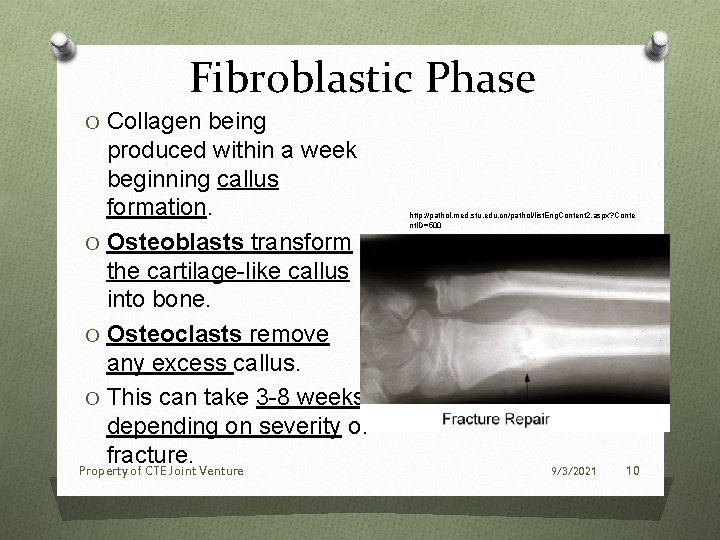 Tissue Healing Fracture Healing 1 932021 Bellwork Take