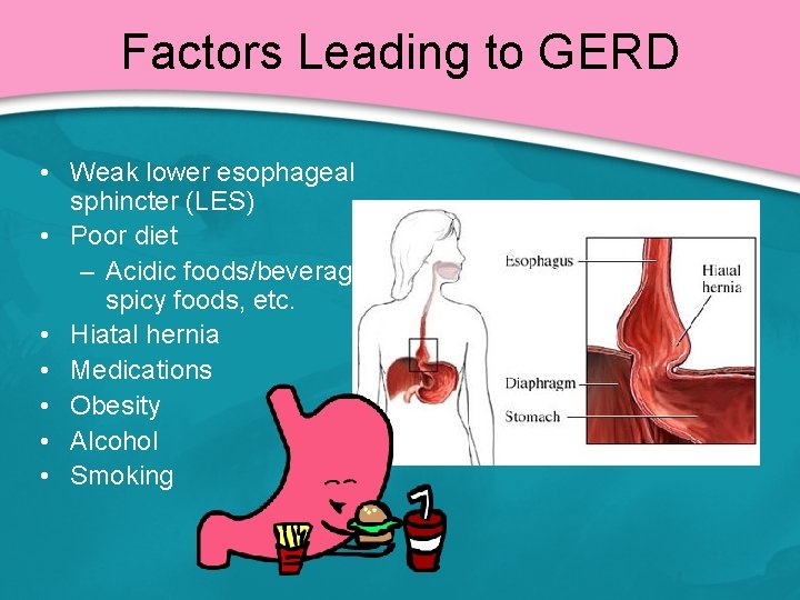 Topics Background Gastric Acidity What is GERD Factors