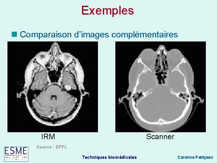 Techniques biomdicales Le traitement dimages mdicales Caroline Petitjean