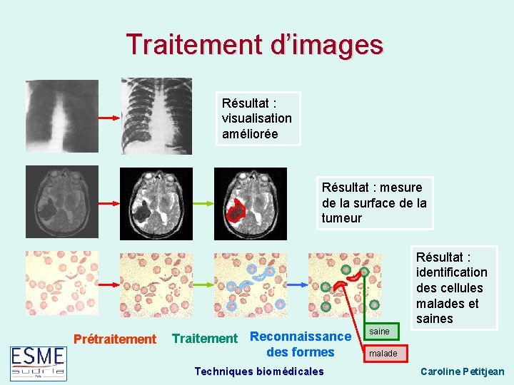 Techniques biomdicales Le traitement dimages mdicales Caroline Petitjean