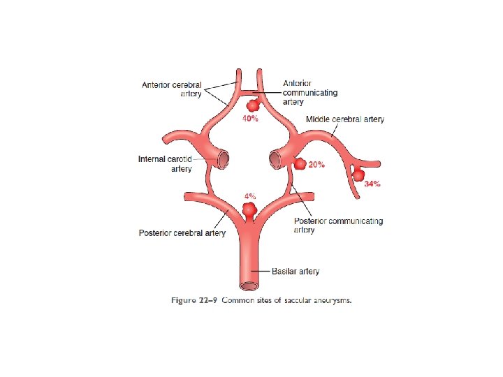 CENTRAL NERVOUS SYSTEM TRAUMA and Subarachnoid Hemorrhage By