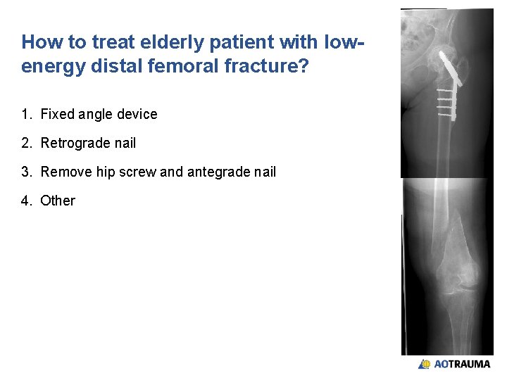 Difficult fracture problems moderated interactive session AOTrauma Advances