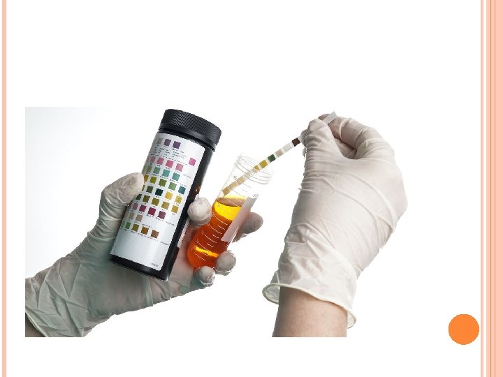 UTI Nebras Abu Abed DEFINITION CLASSIFICATION GENERAL CHARACTERISTICS