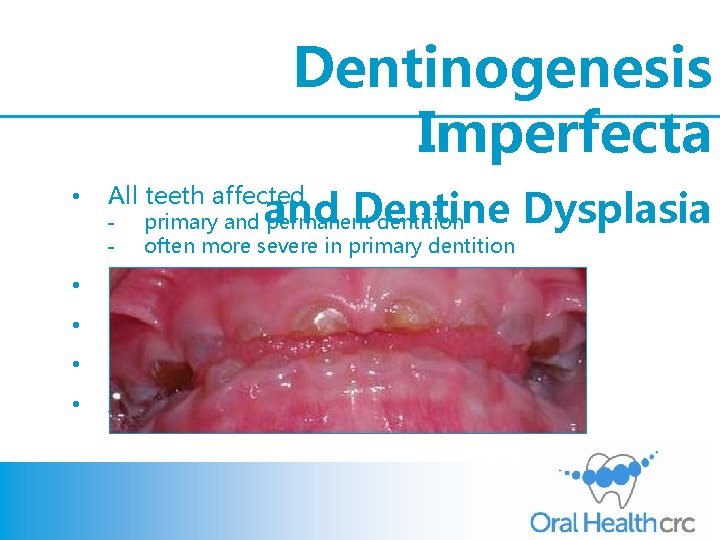 Current evidence on the diagnosis and treatment of