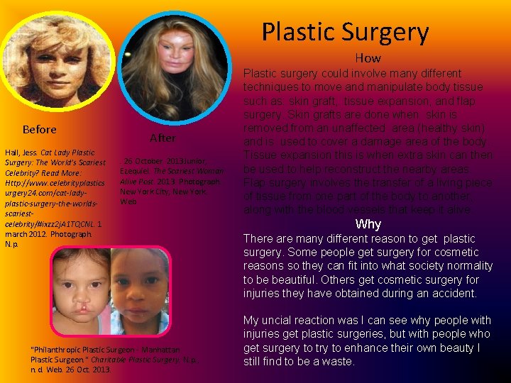 Plastic Surgery How Before Hall Jess Cat Lady