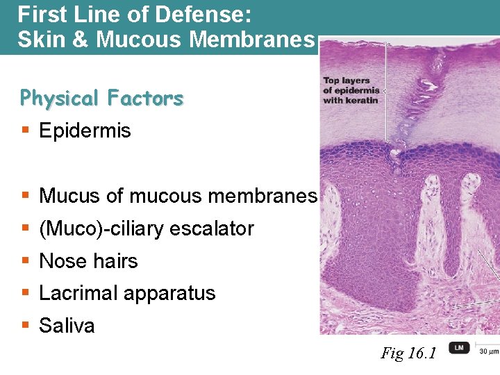 16 Innate Immunity Nonspecific Defenses of the Host