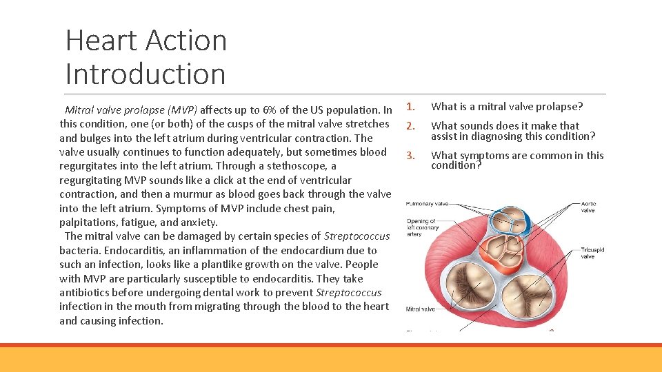 Heart Action Introduction Mitral valve prolapse MVP affects