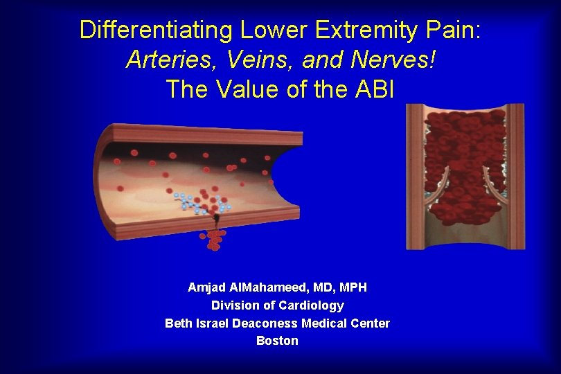 Differentiating Lower Extremity Pain Arteries Veins and Nerves