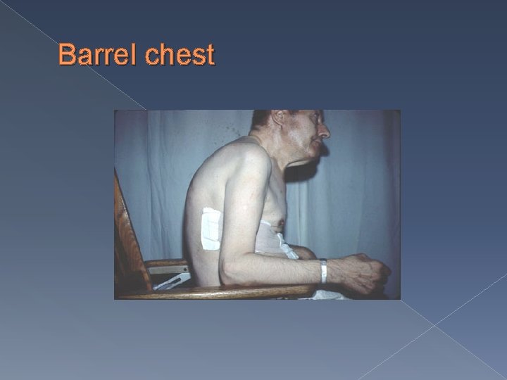 Respiratory System Respiration Unconscious exchange of air between