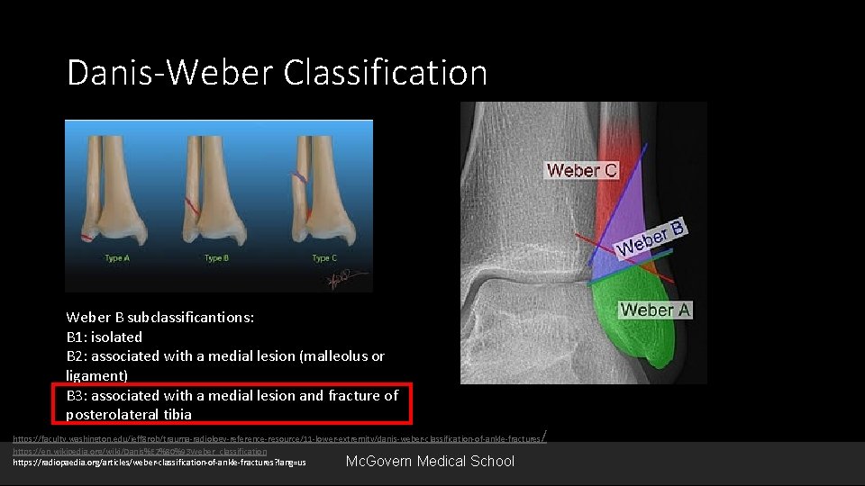 Ground level fall in a patient with cerebral