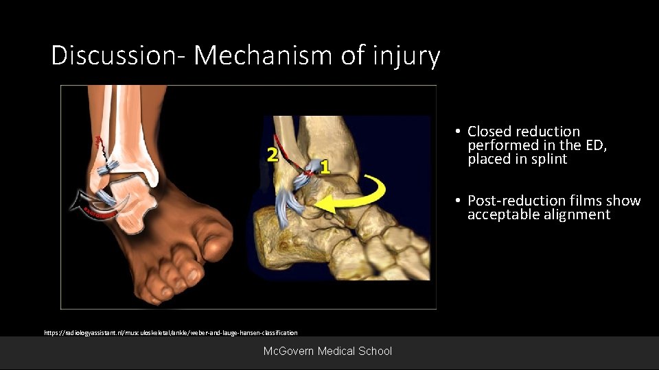 Ground level fall in a patient with cerebral