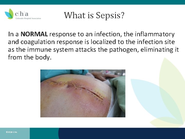 Sepsis 101 Colorado Hospital Association 2019 CHA Objectives