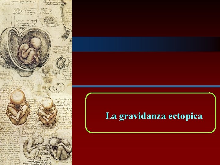 La gravidanza ectopica L annidamento fisiologico Lannidamento patologico