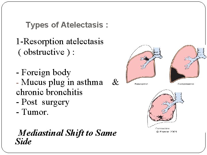 Pathology of the Respiratory System Dr Bushra AlTarawneh
