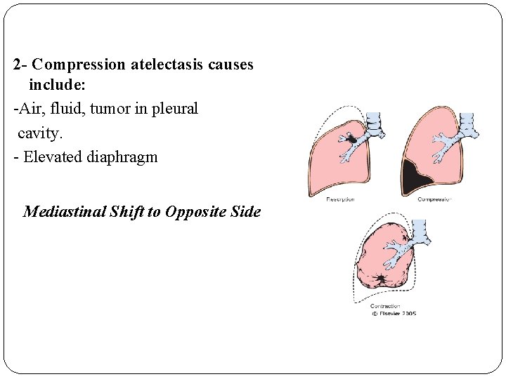 Pathology of the Respiratory System Dr Bushra AlTarawneh
