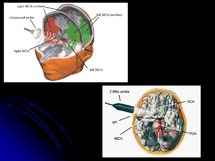 The impact of typical and atypical language dominance