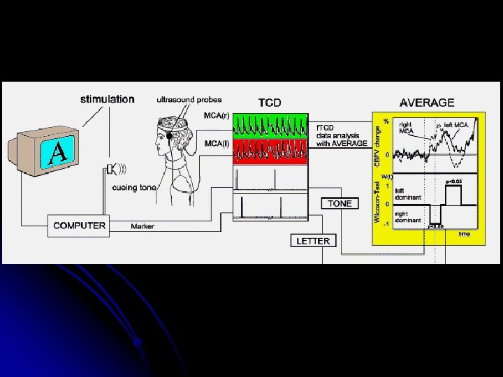 The impact of typical and atypical language dominance