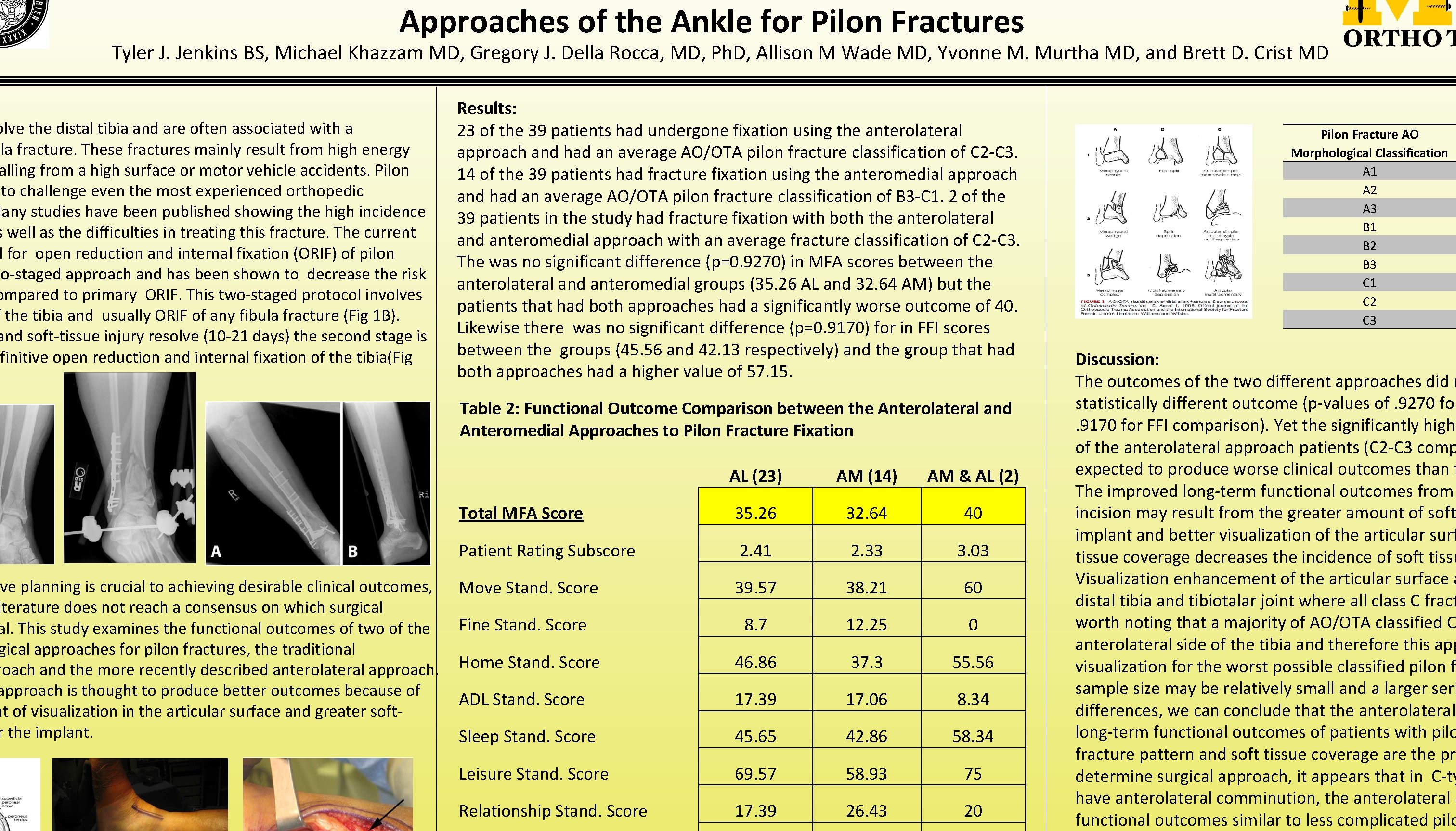 Approaches of the Ankle for Pilon Fractures Tyler