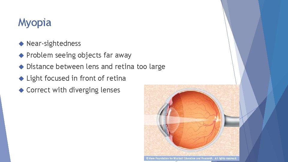 The Eye Human Eye Front of the eye