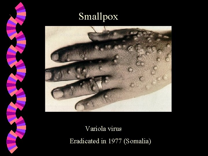 Control of Microbial Growth Pathogenic Microorganisms Prionsproteins Kuru