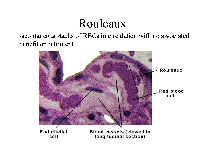 Cardiovascular System Blood Anatomy Physiology II Tony Serino