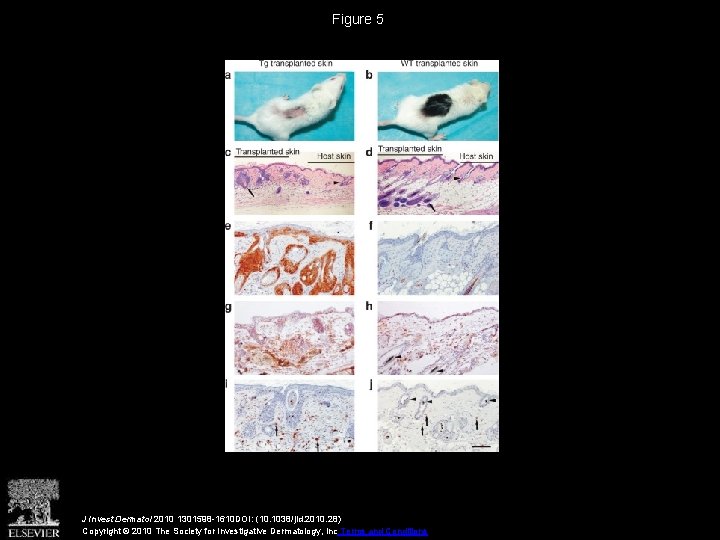 IKK Leads to an Inflammatory Skin Disease Resembling