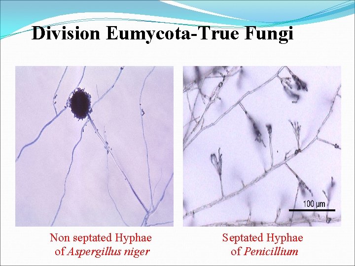 Microbiology Introduction to Mycology Division EumycotaTrue Fungi Non