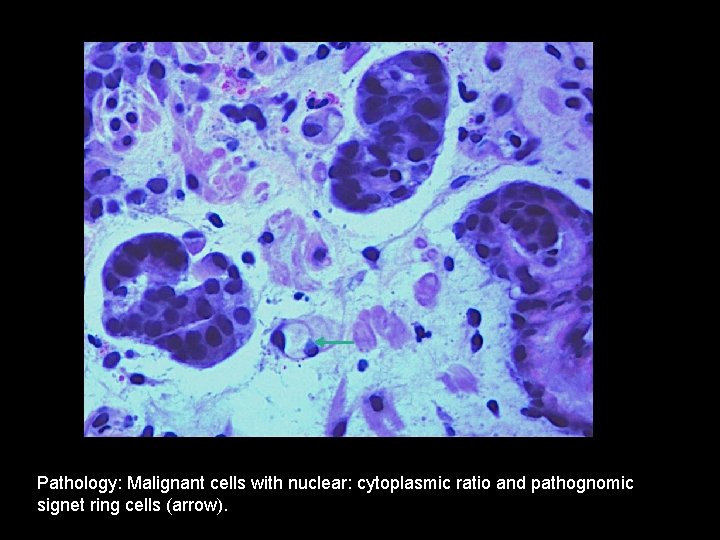 Radiology Pathology Gastric Pathology Before You Begin This