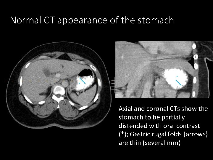 Radiology Pathology Gastric Pathology Before You Begin This
