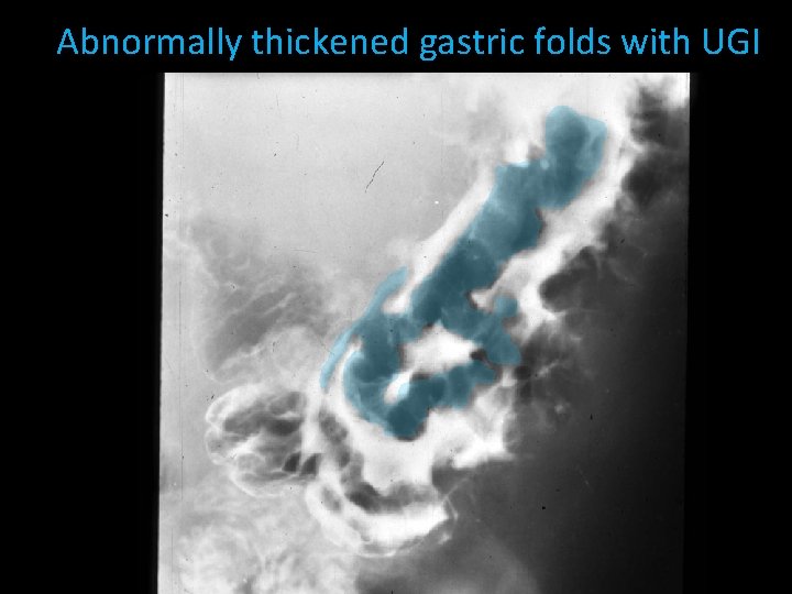 Radiology Pathology Gastric Pathology Before You Begin This