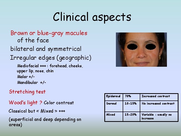 MELASMA Differential diagnosis Greek melas black Complex and