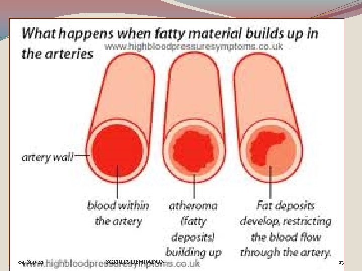 TARGETTED ORIENTED DRUG DELIVERY LIPOPROTIENS Prepared By Dr