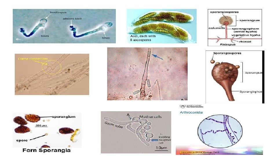 Practical medical mycology Lab 8 Yeast Identification Introduction
