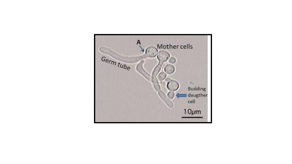 Practical medical mycology Lab 8 Yeast Identification Introduction