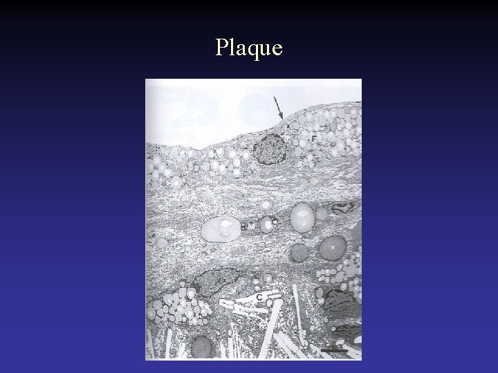 Vesicular Transport IV Chapter 13 3 possible fates