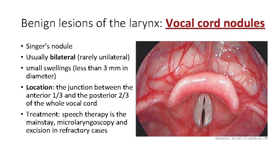 Anatomy of the larynx and benign lesions of