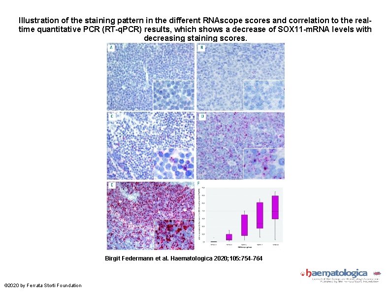 Highly sensitive and specific in situ hybridization assay