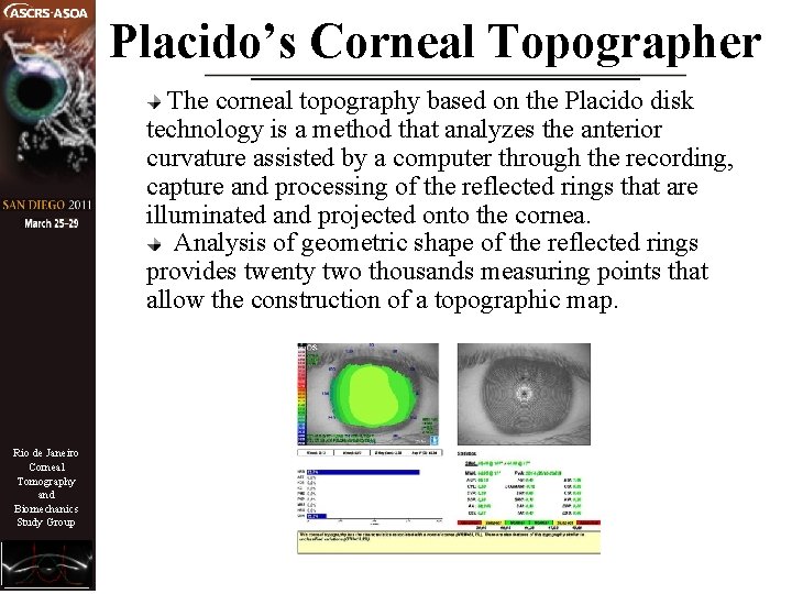 Agreement of Artificial Intelligence Topographic Diagnosis From Placido