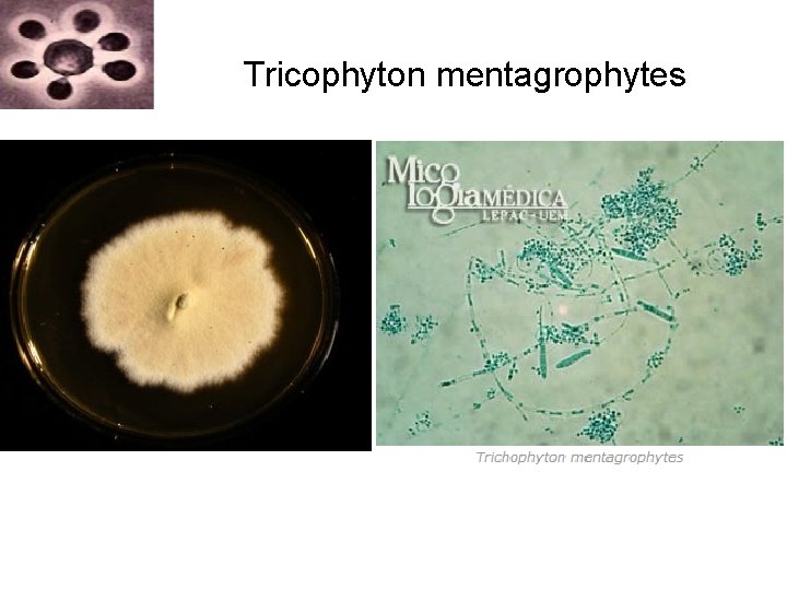 Micologia micoses superficiais e sistmicas Universidade de Santo