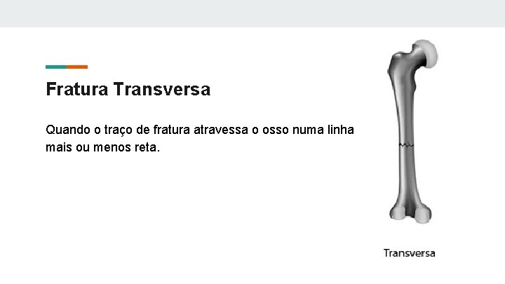 Tipos de Fraturas Flaviane Assuno Isabella Paes Eric
