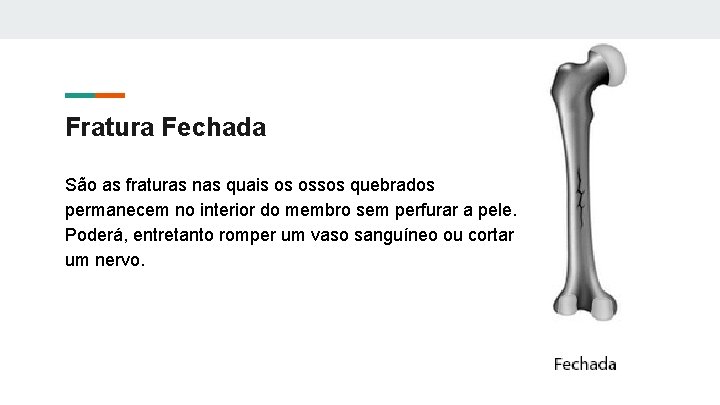 Tipos de Fraturas Flaviane Assuno Isabella Paes Eric