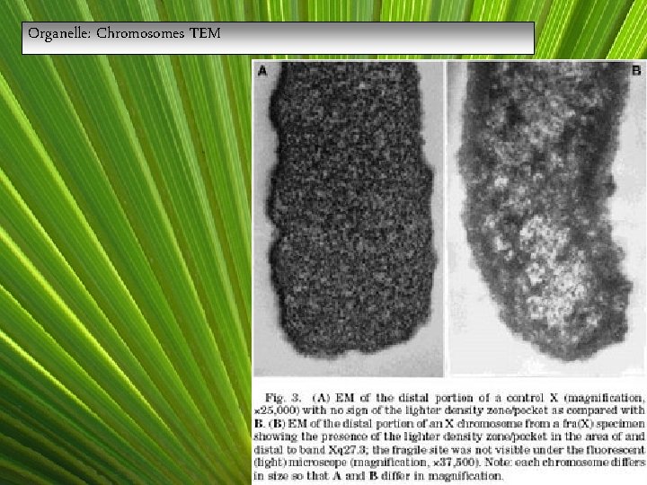Cell Membrane Cytoplasm Nucleus Nucleolus Mitochondria Endoplasmic ...